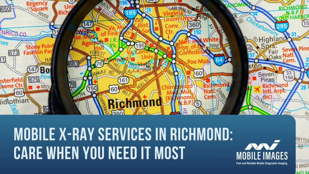 Mobile X-Ray Services in Richmond: Care When You Need It Most - Mobile ...